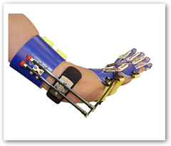 Medical-device maker Saebo Retrains Stroke Patients To Regain Use of ...